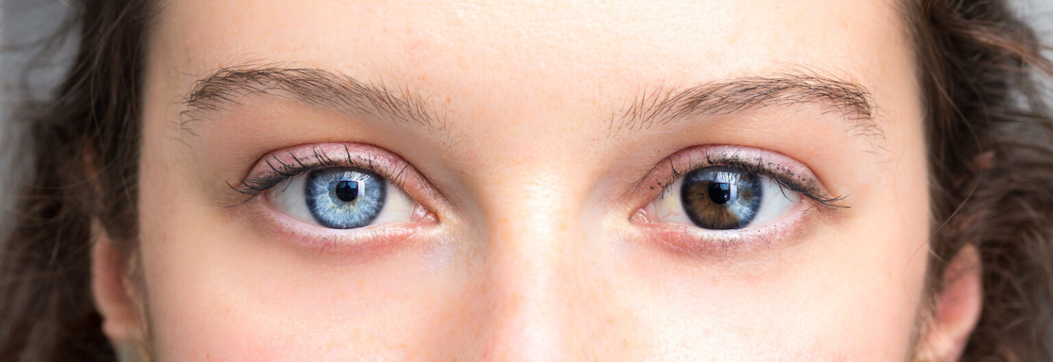What Is the Most Common Eye Color in the World? | Color Meanings